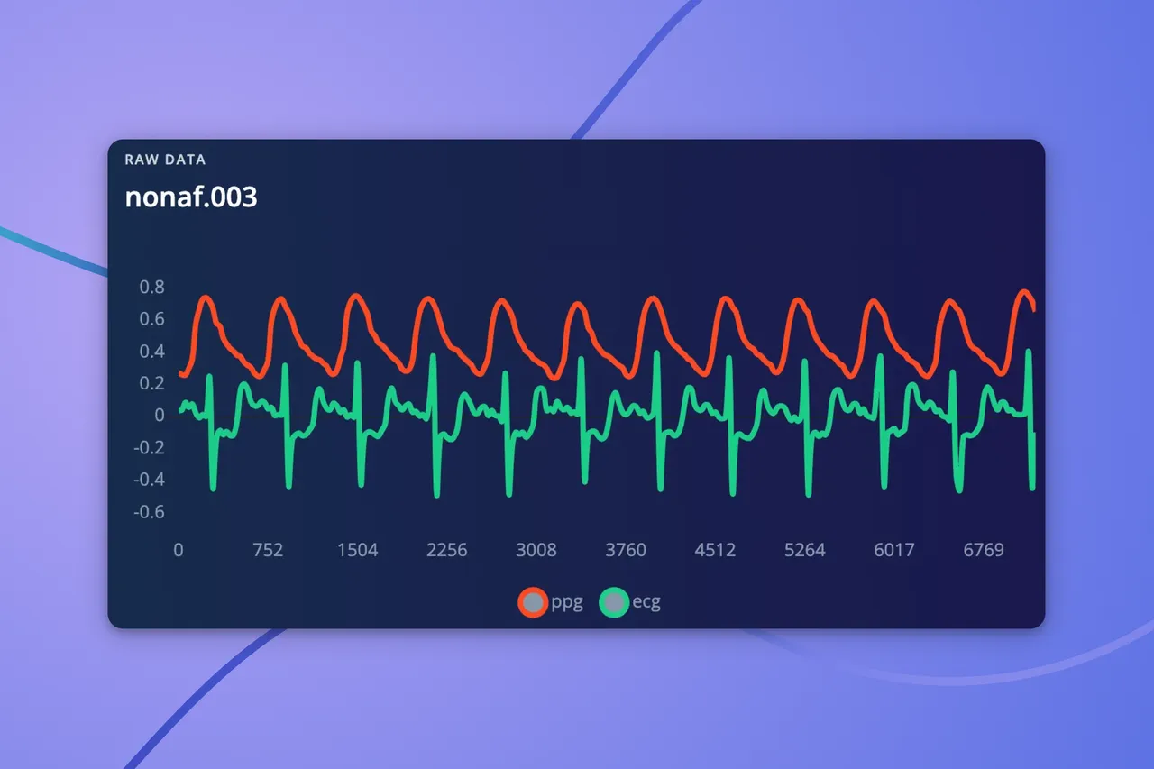 Getting the Pulse: Technical Insights Into Edge Impulse's New HR and ...